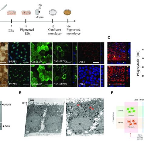 Generation Of Ipsc Rpe Cells From Patient And Control A Schematic Download Scientific