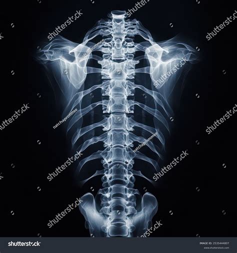 Xrays Spine Normal Cervical Spine X Ray Stock Image C039 3919