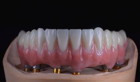 ЕВА стоматология Ураааа Завтра у феи зубов мудрости и повелительнице имплантов день