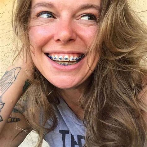 Braces Giveaway Risas Dental And Braces