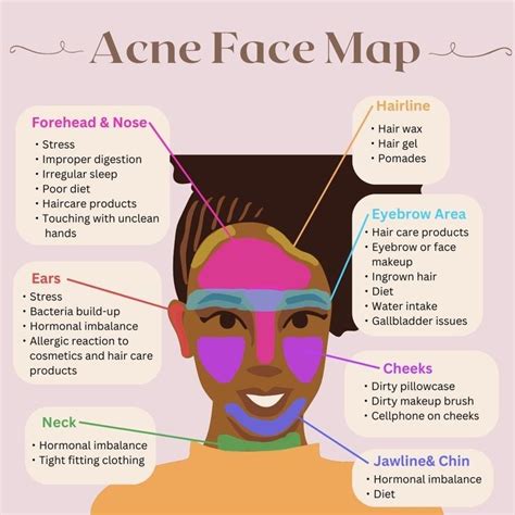 Title Understanding Acne Exploring The Different Types And How To Tackle Them Skbeautyhub Artofit