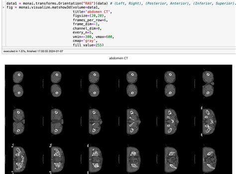 如何用python显示3d医学图像？monai这个功能太好用~python Monai Csdn博客