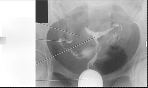 AP HSG Diagram Quizlet