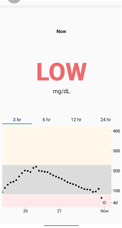 Suddenly Permanent Low R Dexcom