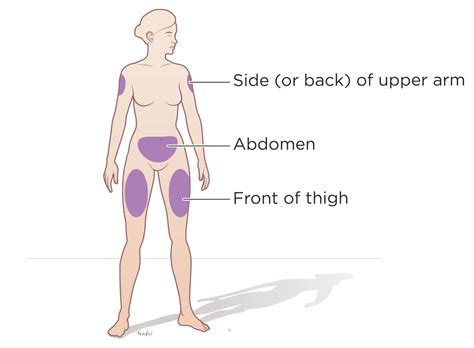 Insulin Injection Sites Where And How To Inject Injections Insulin
