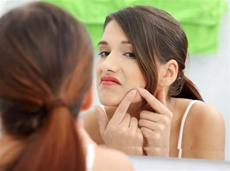 How To Remove Pimples Naturally Making Different