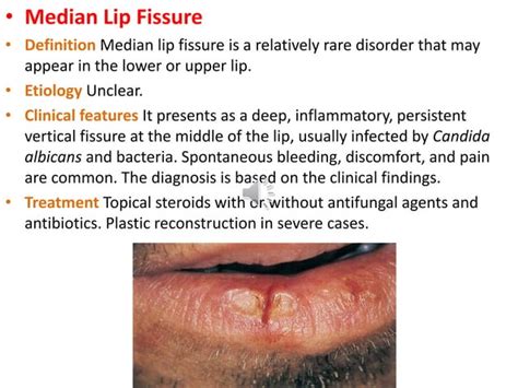 Lip Diseasespdf