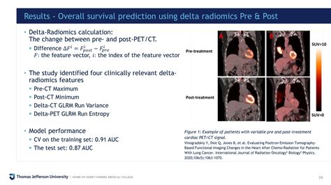Artificial Intelligence To Reduce Radiation Induced Cardiotoxicity In Lung Cancer Radiotherapy