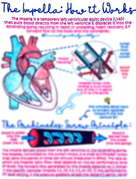 How The Impella Works Etsy