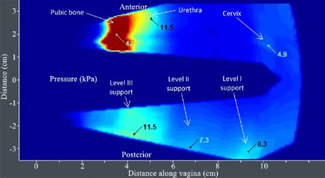 A Tactile Image Acquired During The VTI Probe Elevation Test 2 With Download Scientific