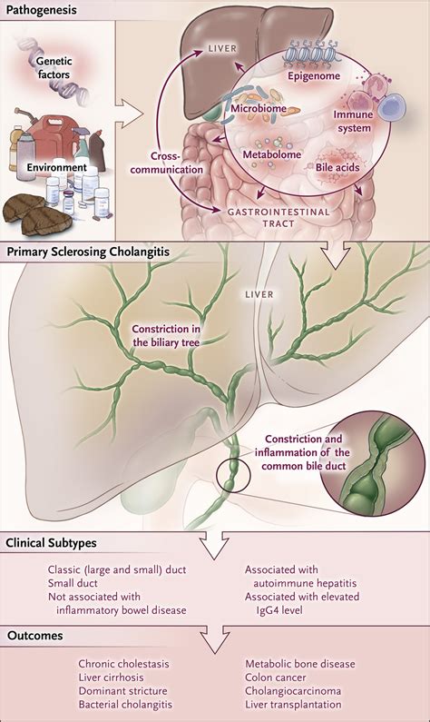 Primary Sclerosing Cholangitis Nejm