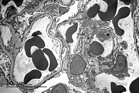 Normal Glomerulus Electron Microscopy