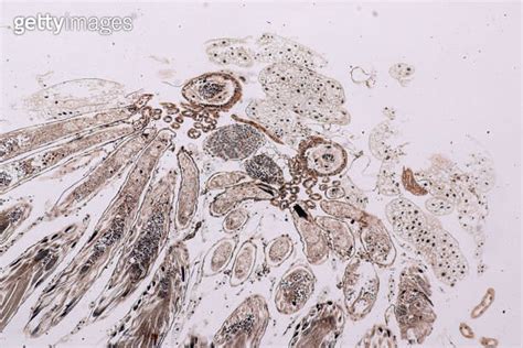 Education Of Grasshopper Testis Under The Microscope In Lab 1179973932 게티이미지뱅크