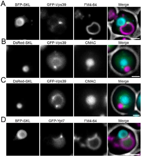 Figure 7 From Peroxisomal Membrane Contact Sites In The Yeast Hansenula Polymorpha Semantic
