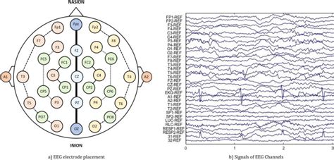 Investigating Population Specific Epilepsy Detection From Noisy Eeg Signals Using Deep Learning
