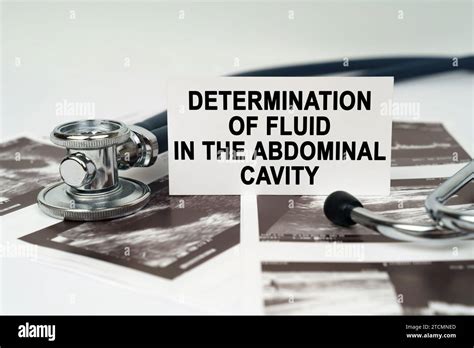 Fluid In Abdomen Hi Res Stock Photography And Images Alamy