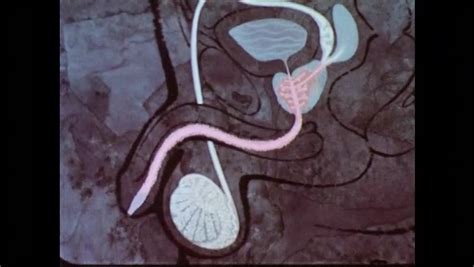 1970s Animation Diagram Of Male Sex Organs Bacteria In Urethra