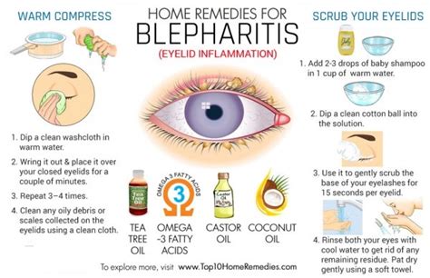 Blepharitis Imu Computer Group 6 Treat The Disease Not The Symptom