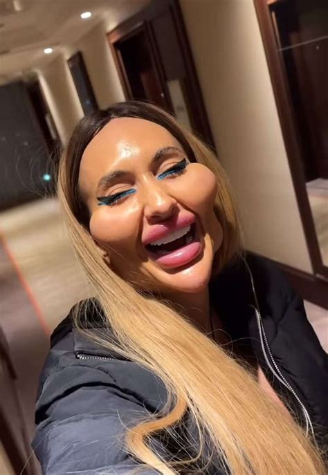 Modelo Impressiona Com Preenchimentos Gigantes No Rosto “as Maiores