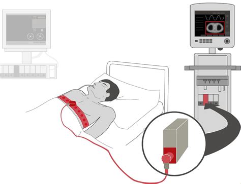 Front End Electronics Integration For Electrical Impedance Tomography