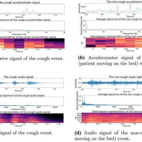Spectrogram Representation Of The Cough And Non Cough Events Shown In Download Scientific