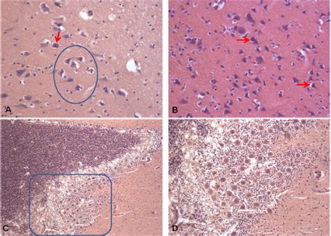 Anp 303 A And B Cortex Dysmorphic And Nodular Neurons Circle Download Scientific Diagram