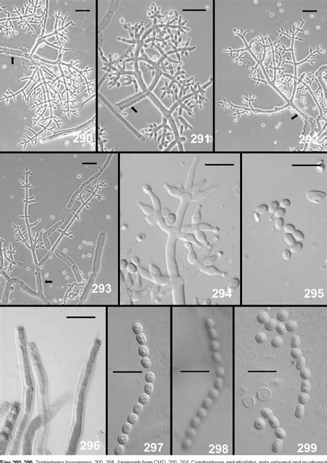 Figure 290 299 From The Trichoderma Koningii Aggregate Species Semantic Scholar