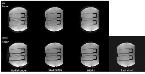 Representative Results Of The Phantom Experiment Using Cs Based And