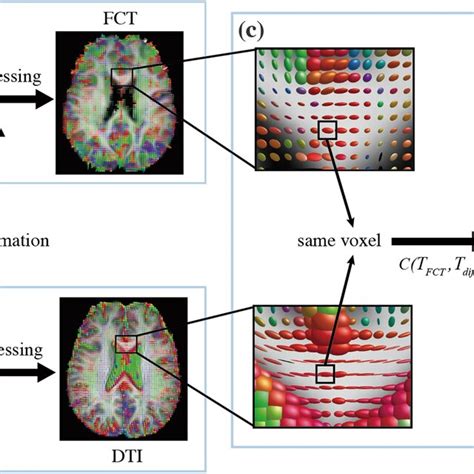 The Group Differences In Fct Dt Consistency In The Wm Tracts And Its