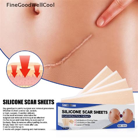 Fwph Silicone Gel Patch Scar Removal Patch Remove Trauma Burn Scar