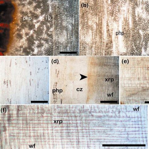 Nuclei Visualization Using Acetocarmine Stain Under Light Microscope