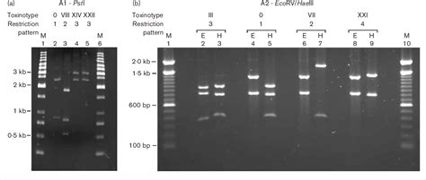 Figure 2 From Distribution Of Clostridium Difficile Variant Toxinotypes And Strains With Binary