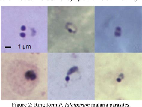 Figure 1 From Computer Automated Malaria Diagnosis And Quantitation