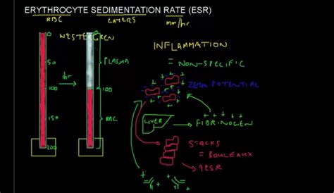 ESR Blood Test Results Explained HRF