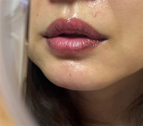 입술반영구문신 부작용 지식in