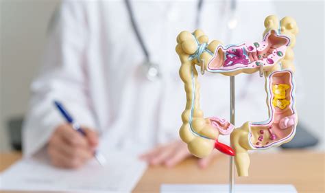 Colon Cancer Care And Cost In India Denvax