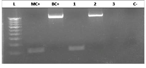 Gel Representing Csf Sample D Pcr For Amplification Of Is6110 Region