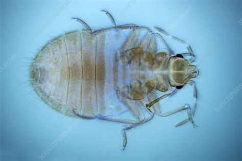 Bed Bug Light Micrograph Stock Image C0494484 Science Photo Library