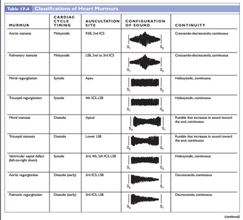 รายการ 91 ภาพ ดูหนัง ออนไลน์ Murmur Of The Heart อัปเดต