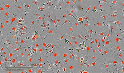 Adcc Assay I Nk Cells I Immuno Oncology Cro Services