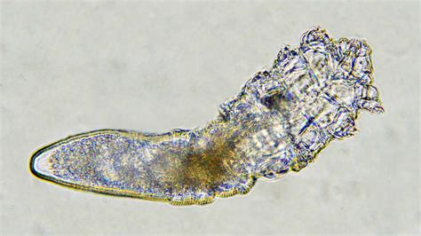 Meet The Mites That Live On Your Face Wbur