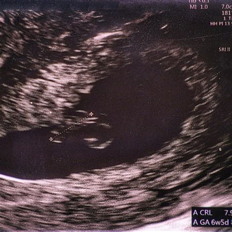 Listen Tents Ghost Hug