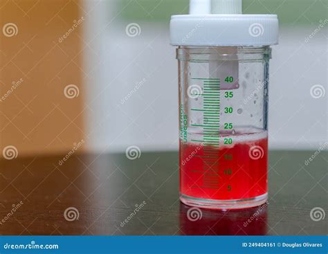Sample Of Bronchial Lavage After Bronchoscopy Of A Patient Stock Image Image Of Instrument