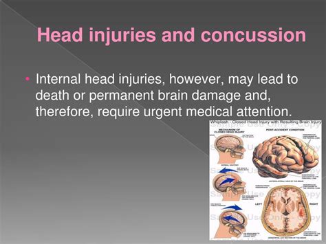 Ppt Management Of Injuries Powerpoint Presentation Free Download