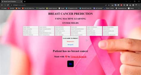 Building A Breast Cancer Prediction Model At Internpe Vignesh Ramesh