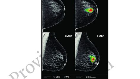 Example Of Artificial Intelligence Application In Two Dimensional