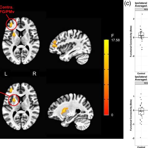 Results Of The Visuomotor‐dependent Connectivity Analysis Corrected Download Scientific