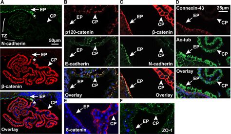 Choroid Plexus And Ependymal Cells Have Distinct Cell Cell Adhesion Download Scientific Diagram Choroid Plexus And Ependymal Cells Have Distinct Cell Cell Adhesion Download Scientific Diagram