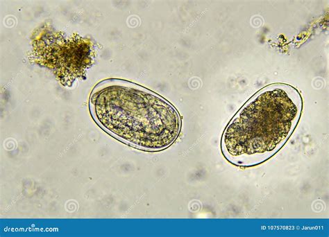 Eggs Of Hookworm In Stool Stock Image Image Of Cestode 107570823