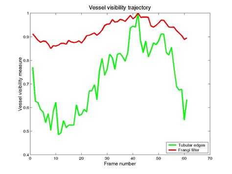Comparison Of Vessel Visibility Trajectories Using Frangi Filter Versus
